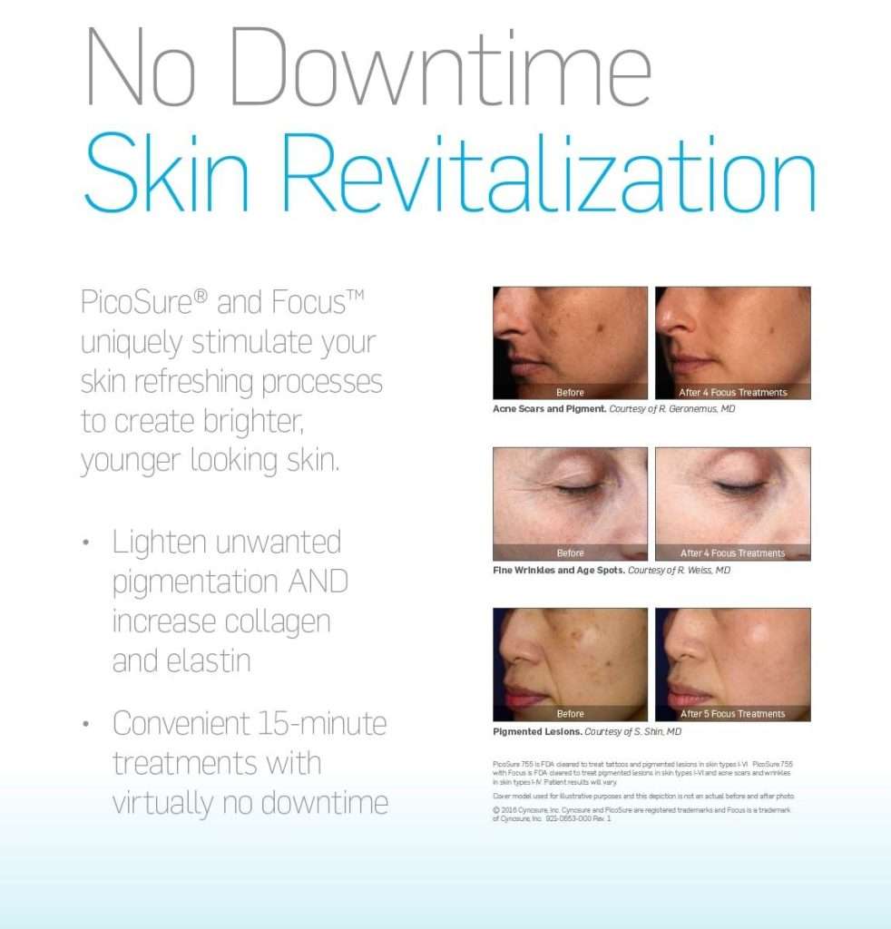 PicoSure Laser: The Ultimate Skin Rejuvenation Solution