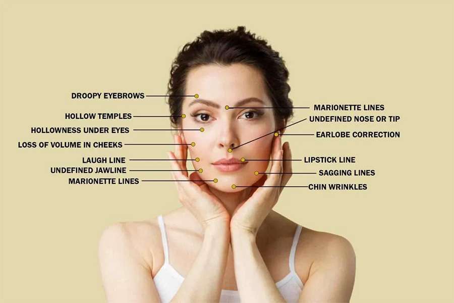 Dermal Fillers Melbourne Richmond Skin And Laser Clinic Dermal Experts